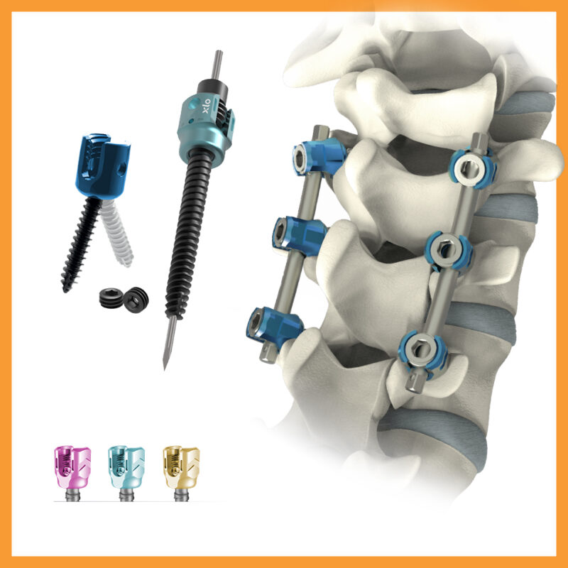 Spine Implant Manufacturers and Supplier, Spine Innovations and Spine ...